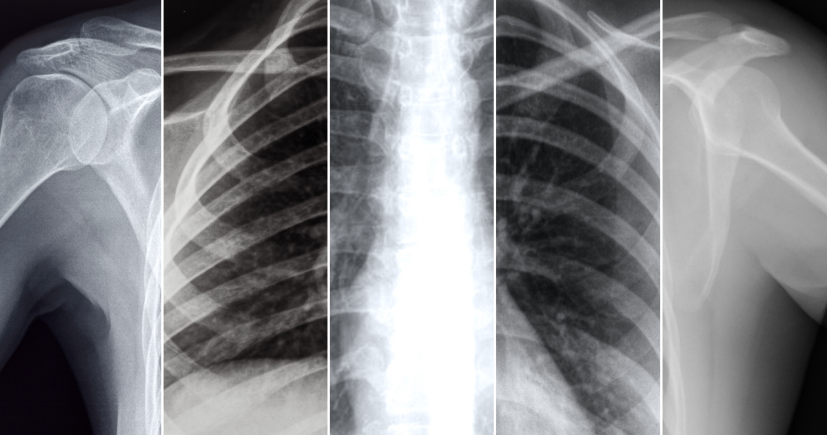 New AI research to help predict COVID-19 resource needs from a series ...